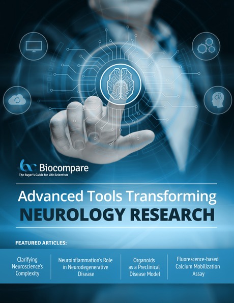 eBook: Advanced Tools Transforming Neurology Research
