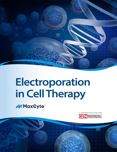 MaxCyte_Aug24_ElectroporationInCell