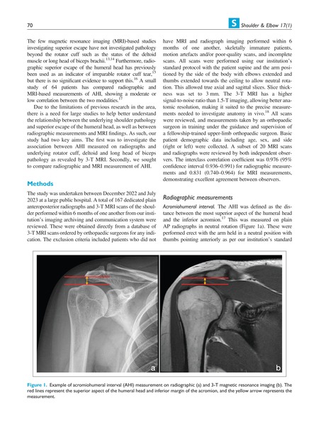 Shoulder & Elbow - February 2025 - 70