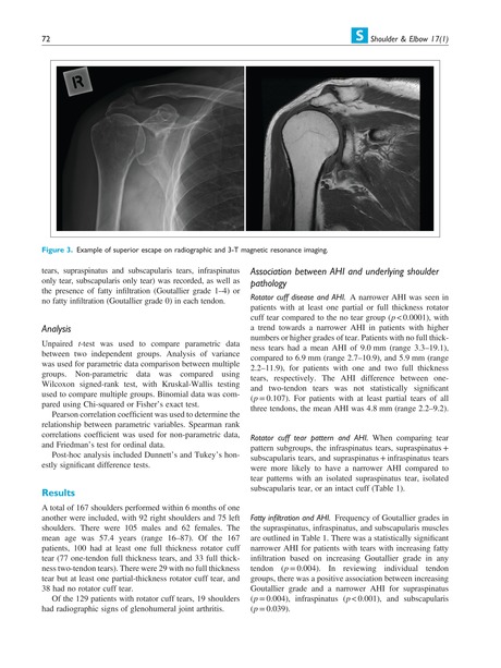 Shoulder & Elbow - February 2025 - 72