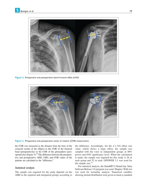 Shoulder & Elbow - February 2025 - 79